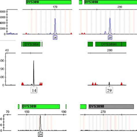 How Mutation At Pcr Primer Binding Sites Gives Rise To Different Pcr
