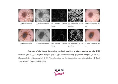 Fundamental Steps In Digital Image Processing Scaler Topics