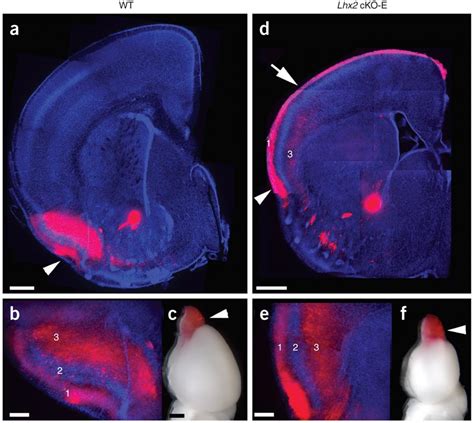 Piriform Cortex Mouse