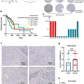 The Correlation Between The TMB Score And The Immune Microenvironment Download Scientific