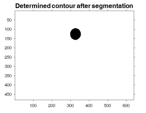 Segmentation Of The Eye Image Using An Adaptive Threshold Based On The Download Scientific