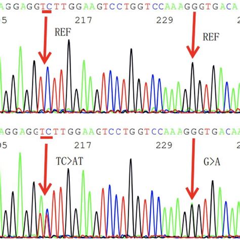 Sanger Sequencing Electropherogram Showing The Two Heterozygous Download Scientific Diagram