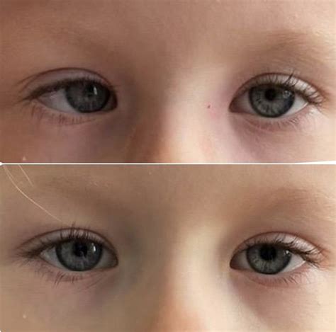 Результаты применения метода Pdtr — P Dtr Global Russia