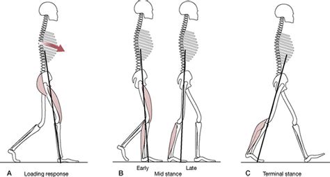 Gait Analysis Neupsy Key