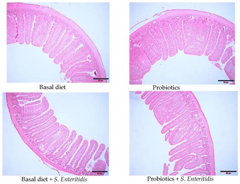 In Vitro Characterization Of Probiotic Strains Bacillus Subtilis And Enterococcus Durans And