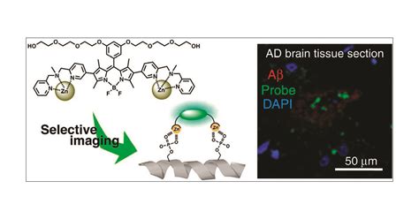 Fluorescent Bodipy Based Znii Complex As A Molecular Probe For Selective Detection Of