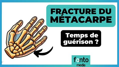 Quel Temps De Guérison Dune Fracture Du Métacarpe à La Main