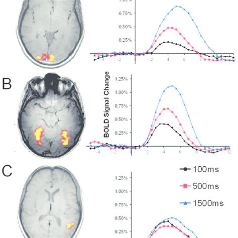 Functional Mri Activity In Visual Cortex Shown Are Fmri Results