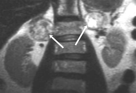 Radiology Adrenal Protocol At Odessa Anderson Blog