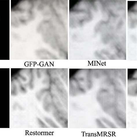 Visual Comparison Between Our Method And State Of The Art Sr Methods On