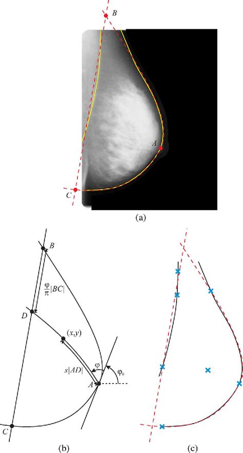 Figure 1 From An Anatomically Oriented Breast Coordinate System For Mammogram Analysis