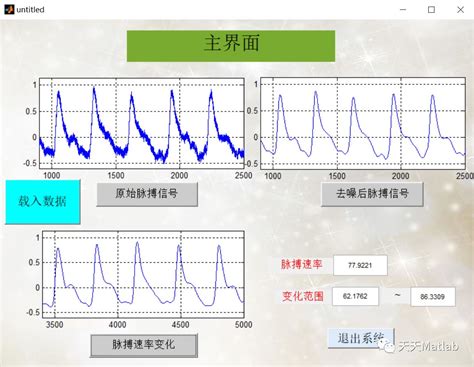 信号处理脉搏信号处理系统含Matlab源码 哔哩哔哩