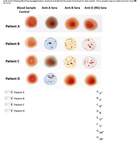 Blood Type Agglutination Chart Eldoncard Blood Typing Kit Ho