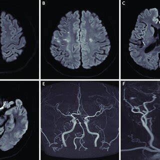 Magnetic Resonance Imaging And Magnetic Resonance Angiography Of The Download Scientific