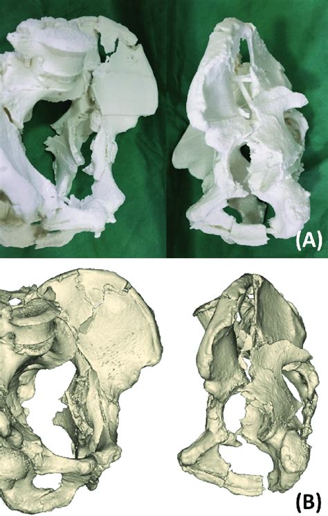 Example Of Three Dimensional Printing A And Virtual Reality B Download Scientific Diagram