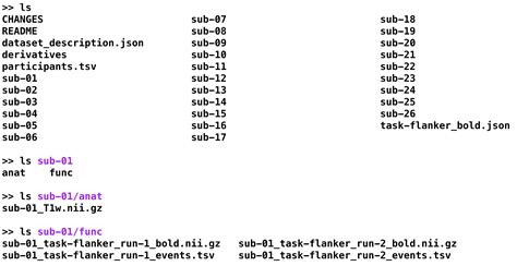 Spm Tutorial 3 Looking At The Data — Andys Brain Book 10 Documentation