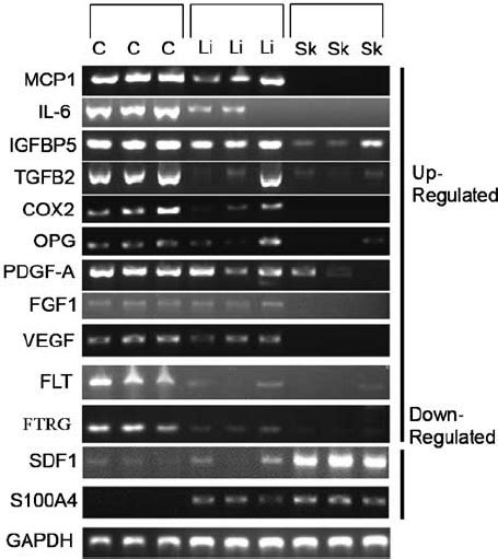 Validation Of The Microarray Data By Semiquantitive Rtpcr Expression