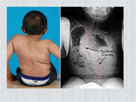 Secondary Structure Of Protein Repeating Structure Of Protein Pptx