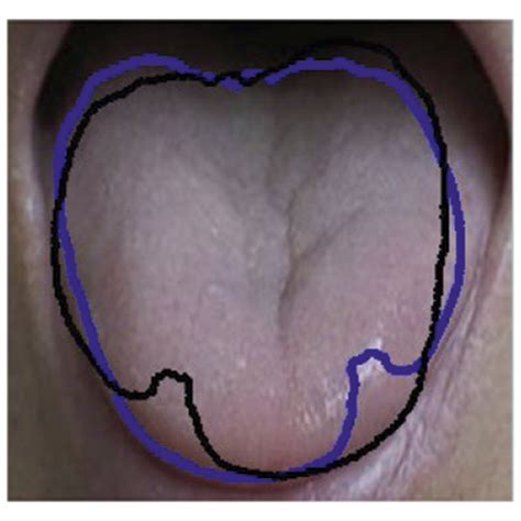 samples of tongue image dataset download scientific diagram