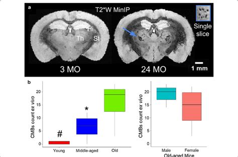 Cmbs Shown With High Resolution T2w Mr Microscopy From Ex Vivo Brains