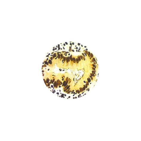 Warthin Starry Stain Kit Azer Scientific