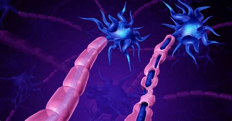 Antibody Attacks And Disease Stabilization Are Key Goals Of The Chronic