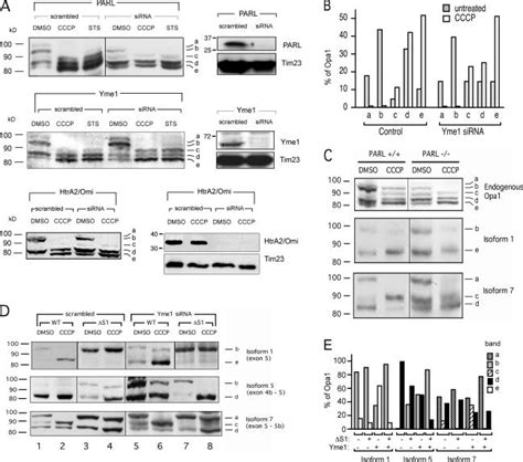 Regulation Of The Mitochondrial Dynamin Like Protein Opa1 By