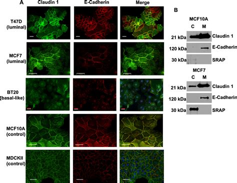 Tissue Microarray Analysis Semantic Scholar