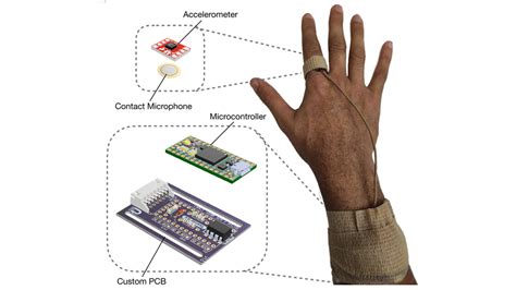 Cmu Sensor Objectively Measures Scratching Intensity