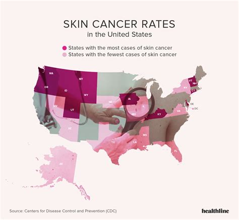 Skin Cancer Graph Skin Cancer Graph