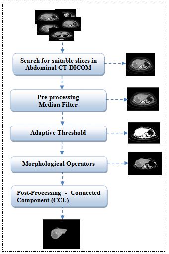 Architecture Of The Proposed Automatic Liver Segmentation System