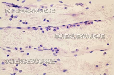 Neutrophils Under Microscope