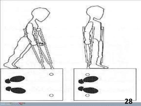 Gait Ppt Pptx Foot Health Diseases And Conditions