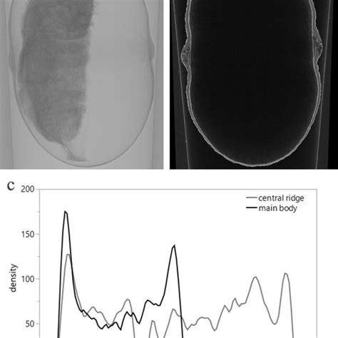 A X Ray Micro Ct Projection B Cross Section Images C
