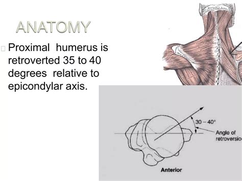 Proximal Humerus Fractures Pptx