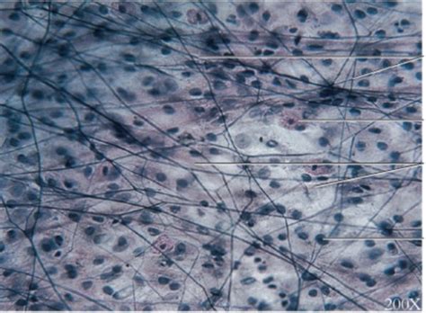Lab Tissues Part Integumentary System Flashcards Quizlet