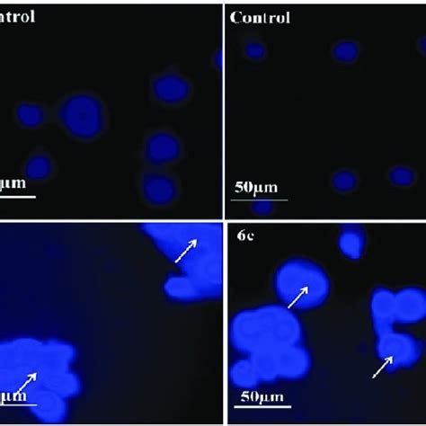 Dapi Apoptotic Analysis Of Treated Mcf 7 Cells And Arrows Indicate Download Scientific Diagram