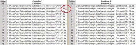 Besa® Brain Electrical Source Analysis Private Features Integrated Workflow