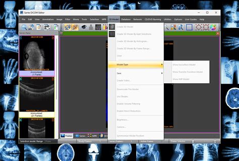 Sante Dicom Editor 软件 官方授权正版软件平台