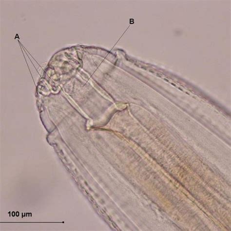 Trichostrongylus Axei Female X 630 A Vulva B Ovajector
