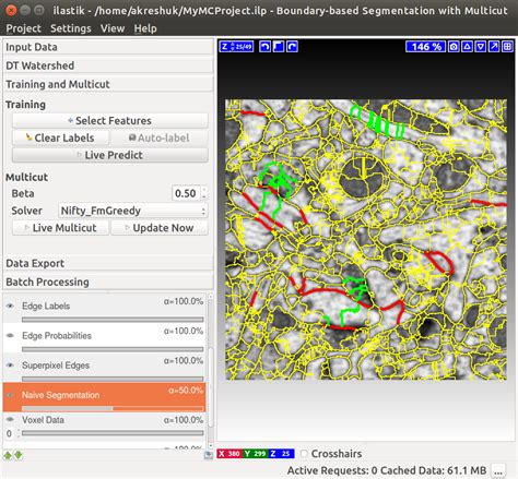 Ilastik Boundary Based Segmentation With Multicut