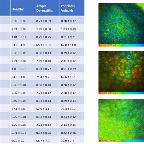 Multiphoton Fluorescence Lifetime Imaging The Mean Fluorescence