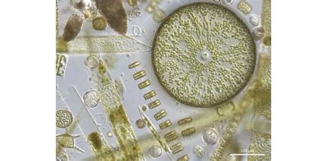 Study Reveals New Insights On Diatom Harming Bacteria