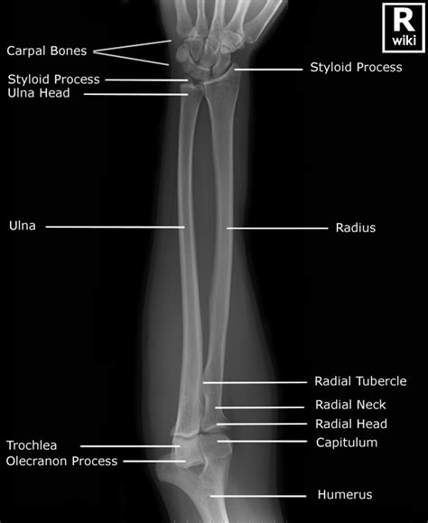 Anatomy Of The Forearm Wikism Sports Medicine Wiki