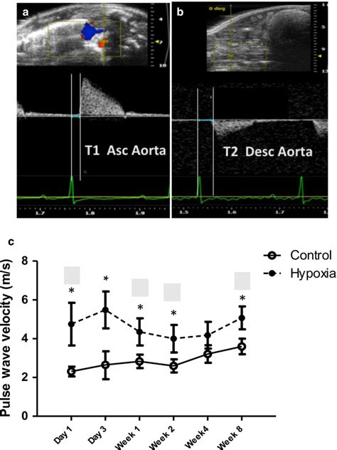 Evolution Of Aortic Pulse Wave Velocity In Prenatal Hypoxia Versus