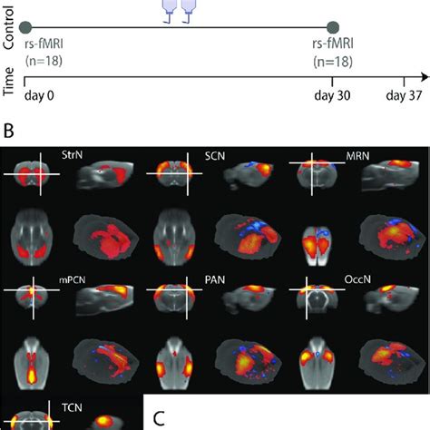 Experimental Rs Fmri Design And Rsns Obtained With Group Pica A Download Scientific Diagram