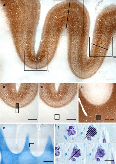 Neuropathologic Measurements A Anti Map2 Staining Of The Frontal