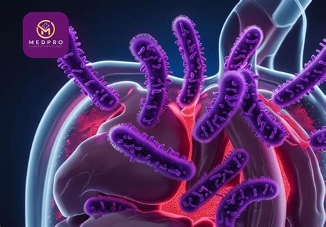 7 H Pylori Symptoms You Shouldnt Ignore Medpro Clinic