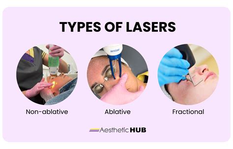 The Best Types Of Laser Treatments For Face