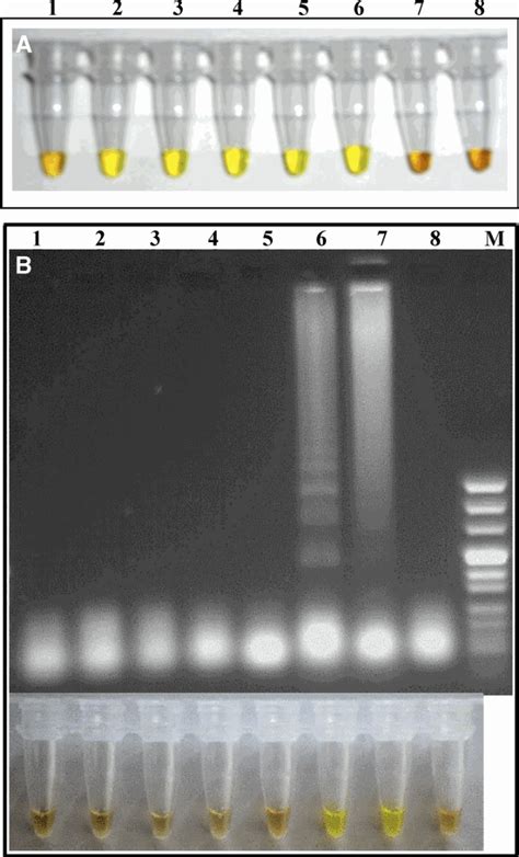 Isothermal Loop Mediated Amplification Lamp For The Detection Of Download Scientific Diagram